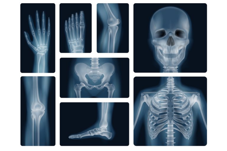 X-Ray Centre in Hadapsar - Savali Multispeciality clinic