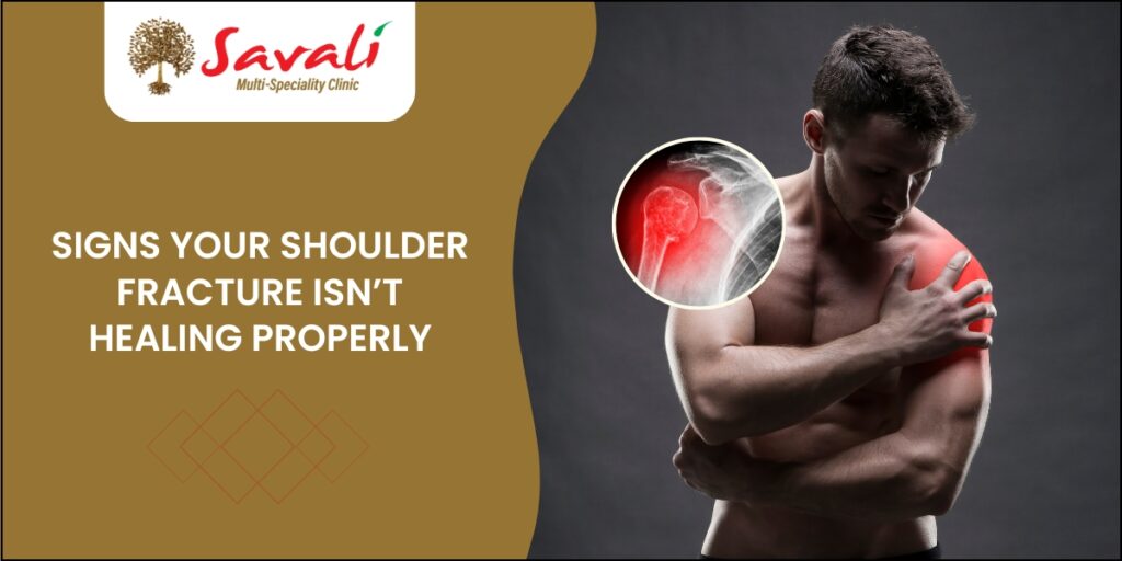 Signs Your Shoulder Fracture Isn’t Healing Properly - Savali ...